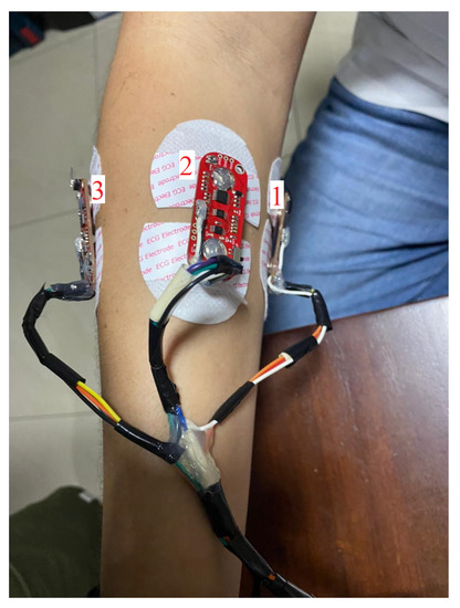 Biomimetics | Free Full-Text | A 3D Printed, Bionic Hand Powered by EMG ...