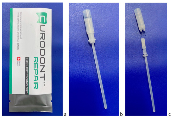 Biomimetic Enamel Regeneration Using Self-Assembling Peptide P11-4