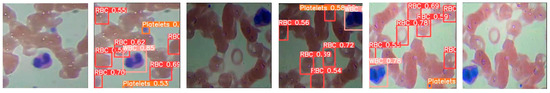 SDE-YOLO: A Novel Method for Blood Cell Detection