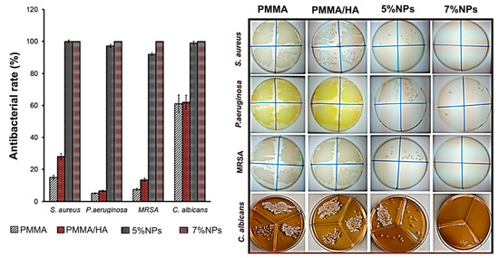 New PMMA-Based Hydroxyapatite/ZnFe2O4/ZnO Composite with Antibacterial ...