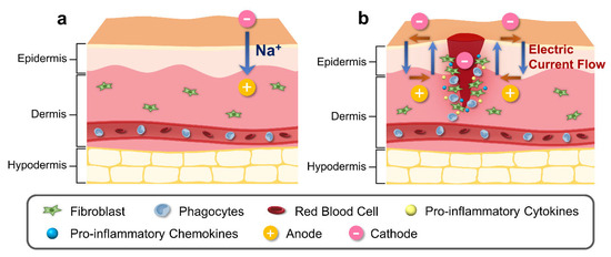 Piezoelectric and Triboelectric Nanogenerators for Enhanced Wound Healing