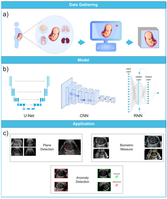 Biomimetics | Free Full-Text | Enhancing Fetal Anomaly Detection in ...