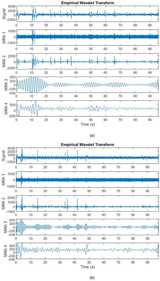 ADHD-AID: Aiding Tool for Detecting Children’s Attention Deficit ...