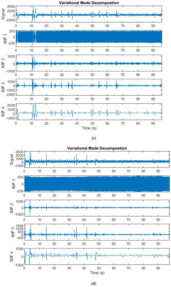 ADHD-AID: Aiding Tool for Detecting Children’s Attention Deficit ...