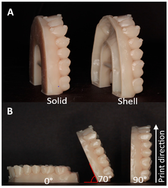 Effect of Model Body Type and Print Angle on the Accuracy of 3D-Printed ...