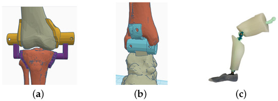 Design of an SMA-Based Actuator for Replicating Normal Gait Patterns in ...