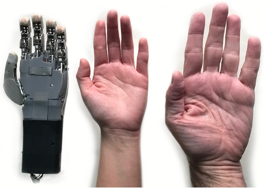 Biomimetics | Free Full-Text | Anthropomorphic Robotic Hand Prosthesis ...