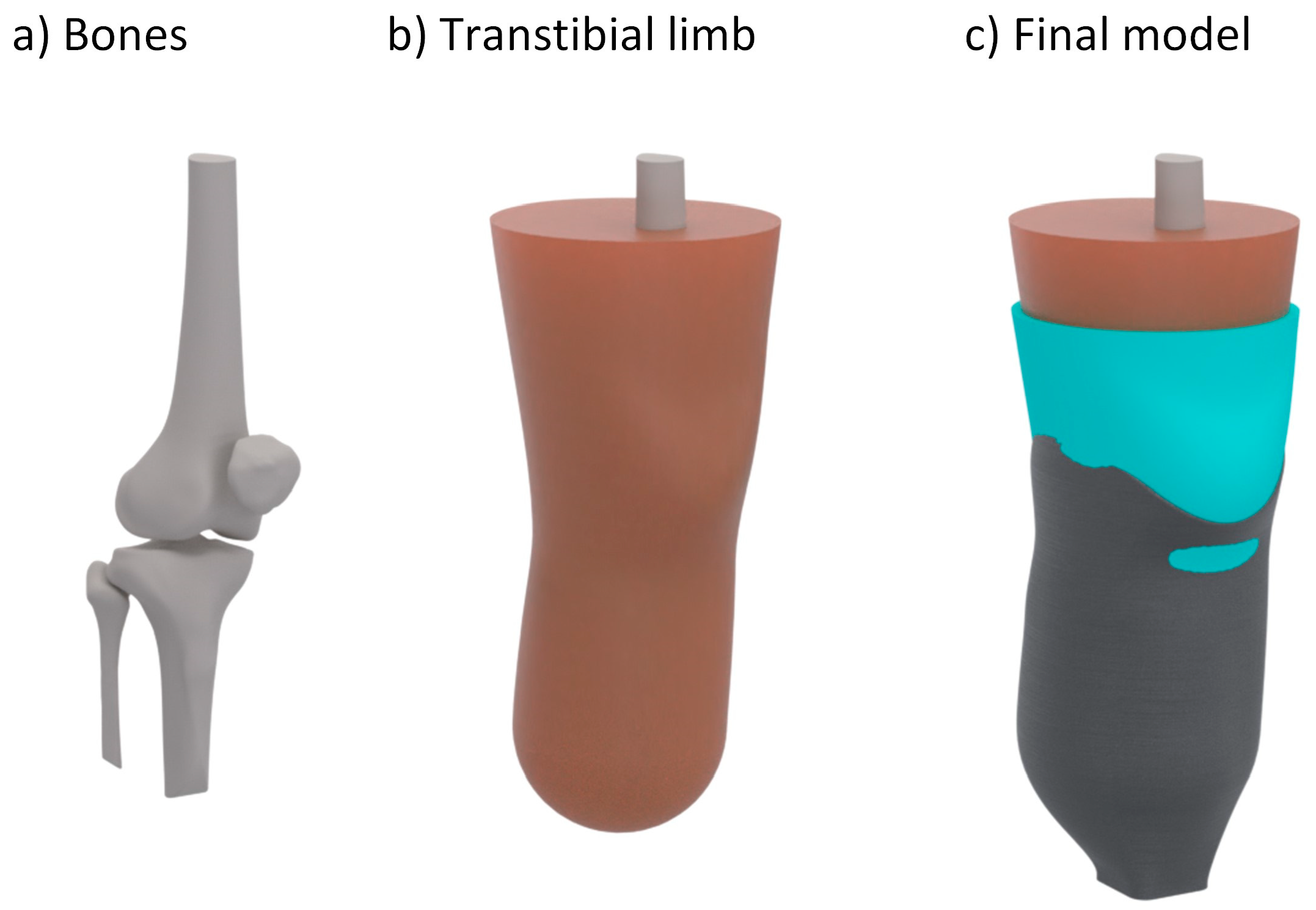 Bioinspired Design of 3D-Printed Cellular Metamaterial Prosthetic ...