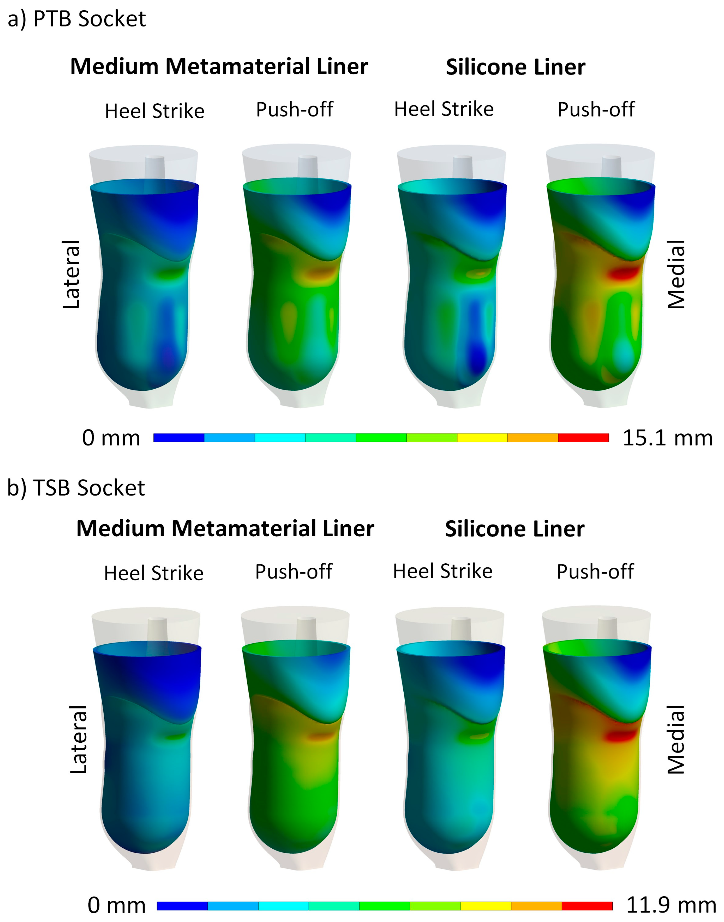 Bioinspired Design of 3D-Printed Cellular Metamaterial Prosthetic ...