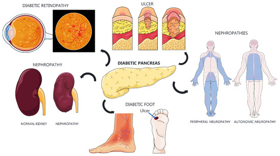 The Role of the Pancreatic Extracellular Matrix as a Tissue Engineering ...