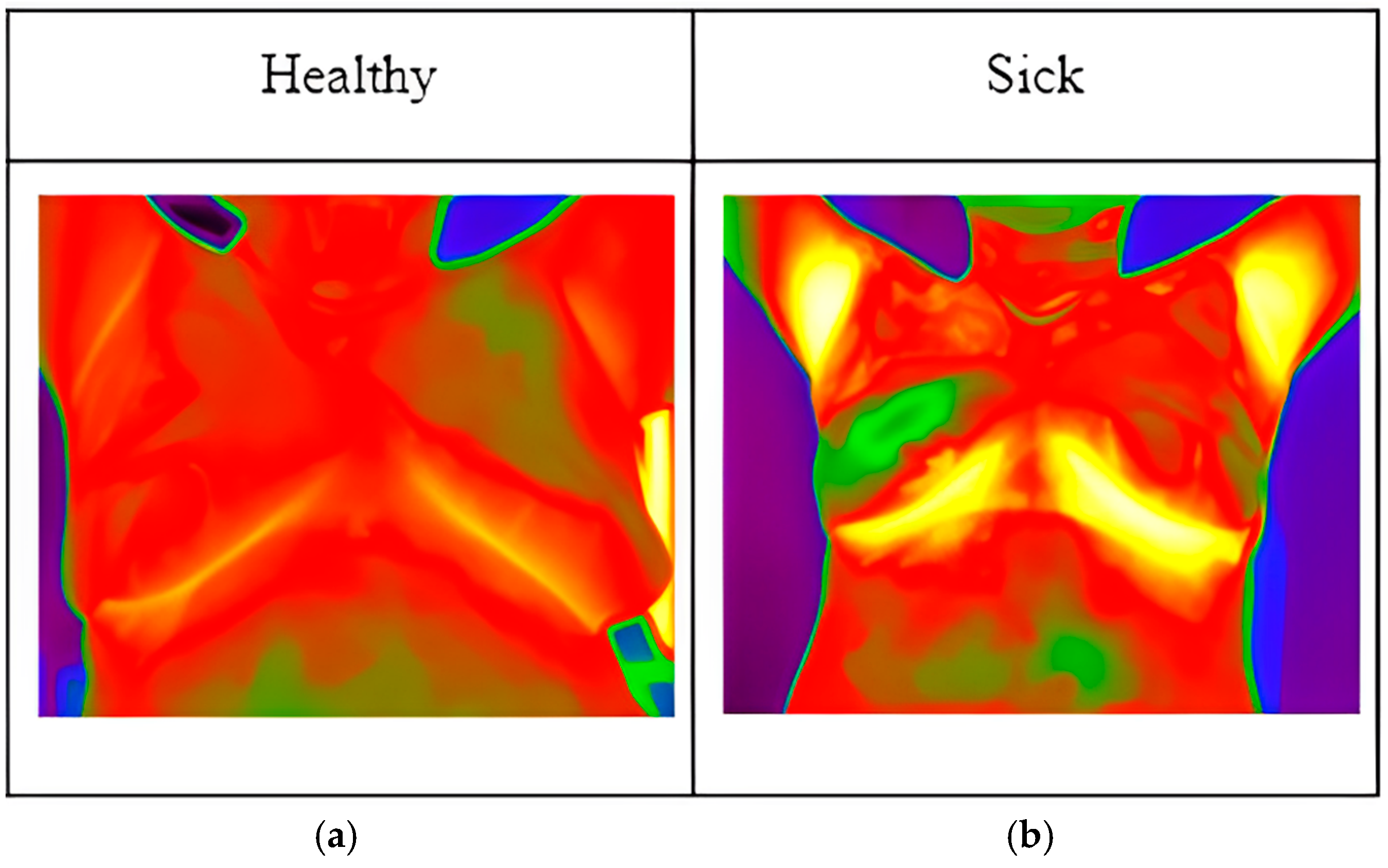 Fully Interpretable Deep Learning Model Using IR Thermal Images for ...