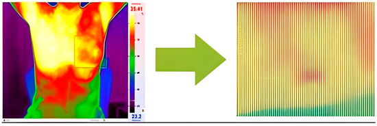 Fully Interpretable Deep Learning Model Using IR Thermal Images for ...