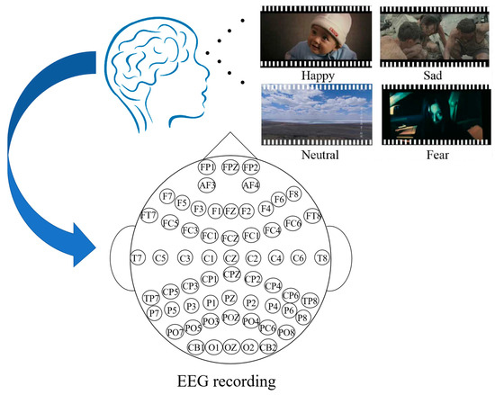 MSBiLSTM-Attention: EEG Emotion Recognition Model Based on Spatiotemporal Feature Fusion