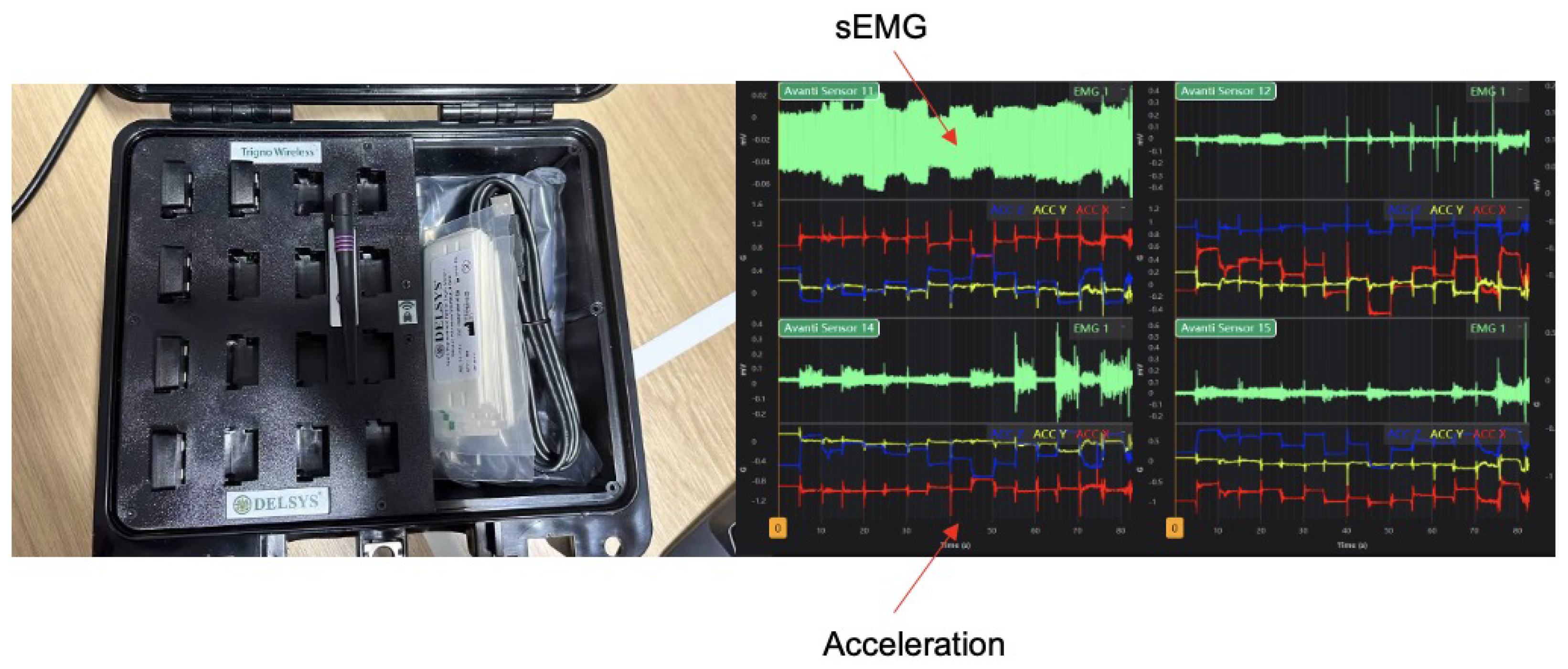 Surface EMG Sensing and Granular Gesture Recognition for Rehabilitative ...