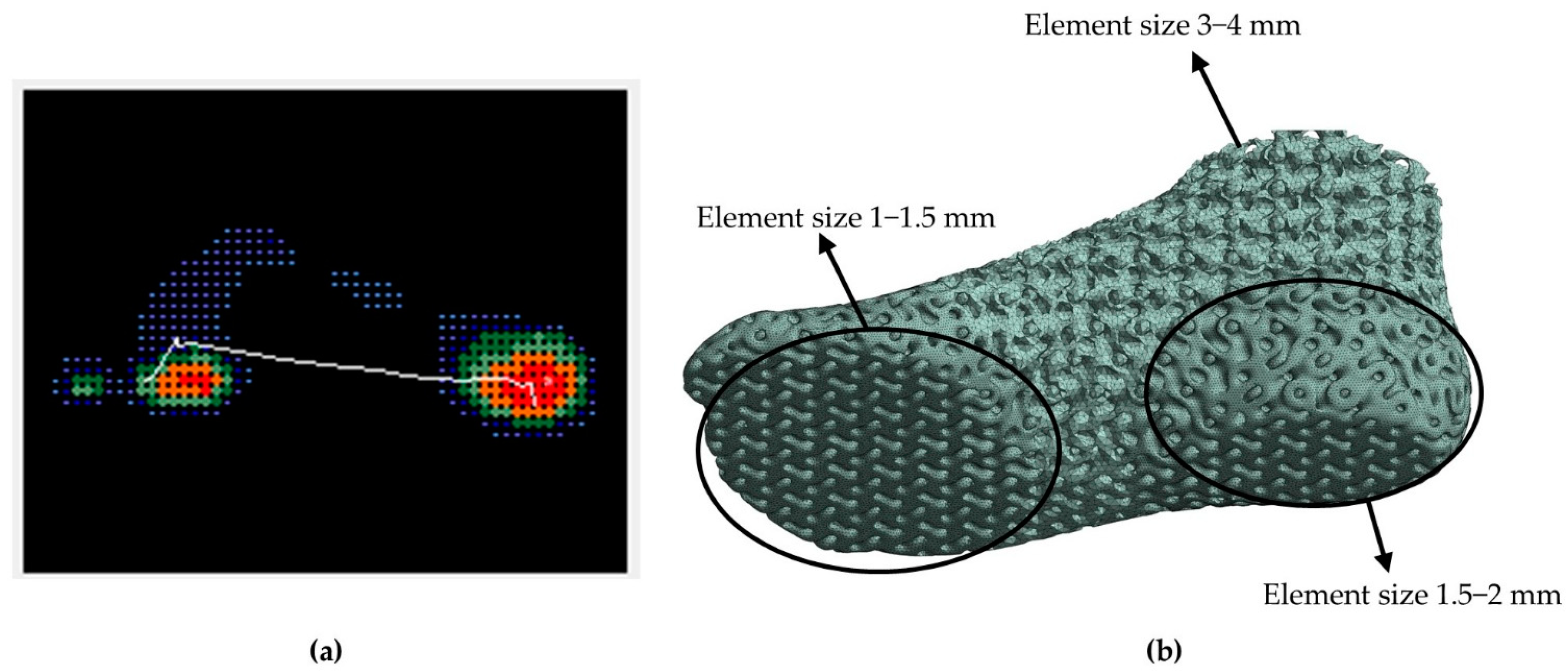 Topologically Optimized Anthropomorphic Prosthetic Limb: Finite Element ...