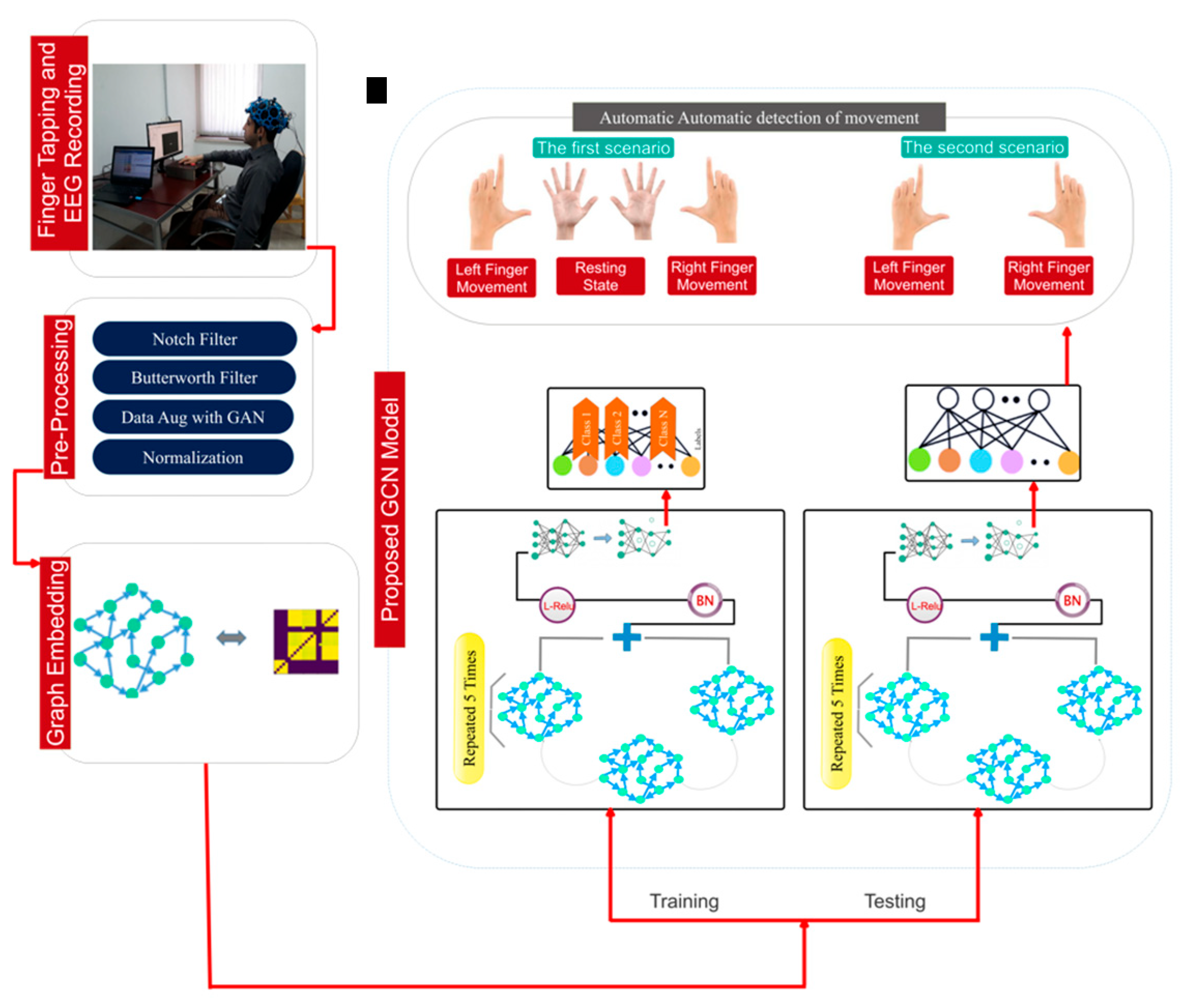 Improved Automatic Deep Model for Automatic Detection of Movement Intention from EEG Signals