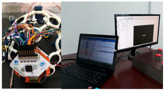 Improved Automatic Deep Model for Automatic Detection of Movement Intention from EEG Signals