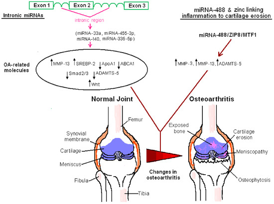 The Role of miRNAs in Common Inflammatory Arthropathies: Osteoarthritis ...
