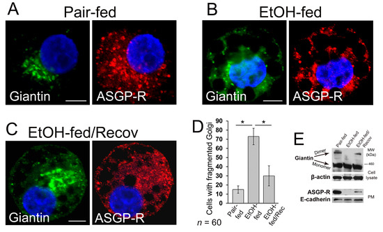 Giantin Is Required for Post-Alcohol Recovery of Golgi in Liver Cells