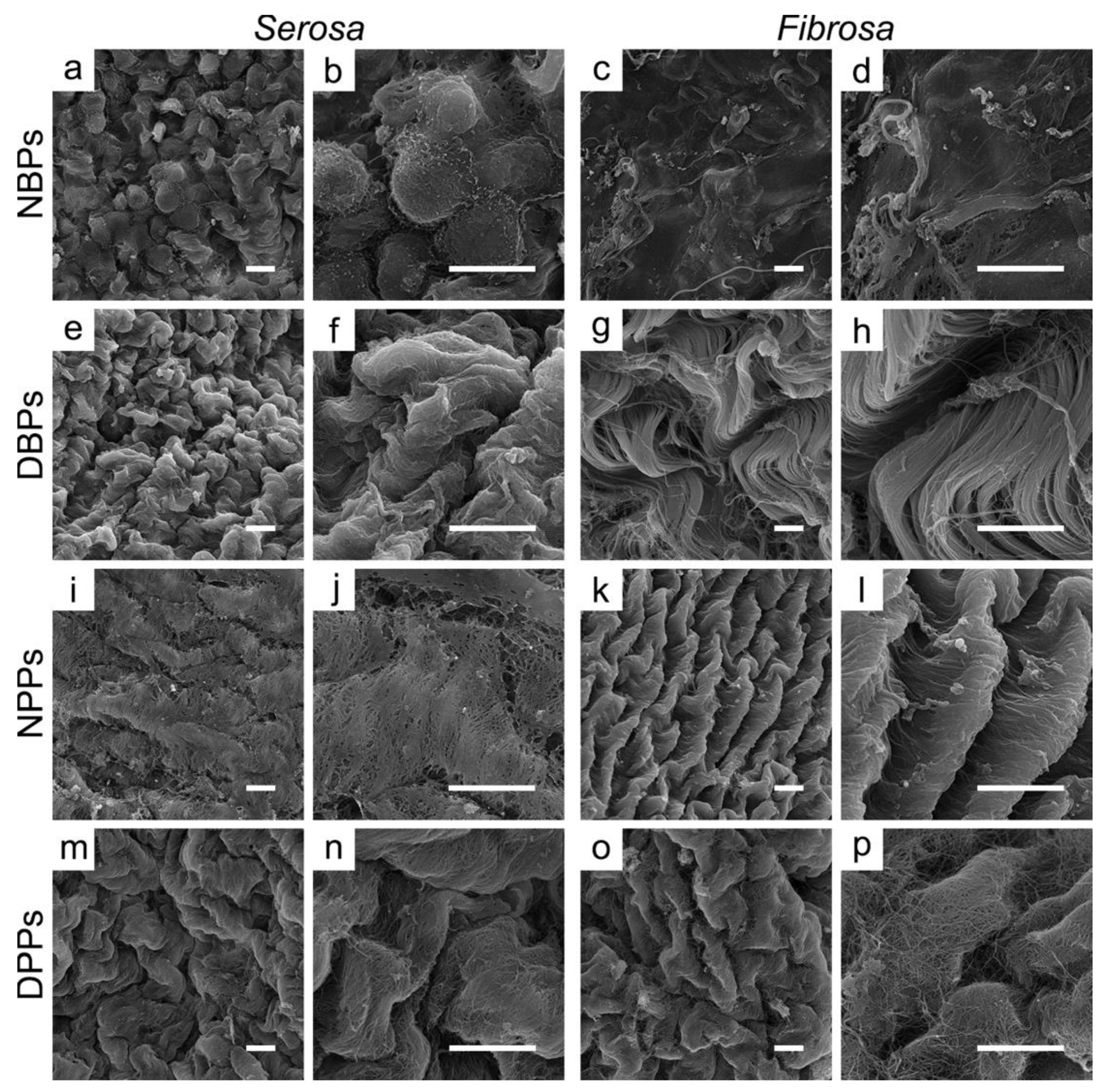 A Comprehensive Comparison of Bovine and Porcine Decellularized ...