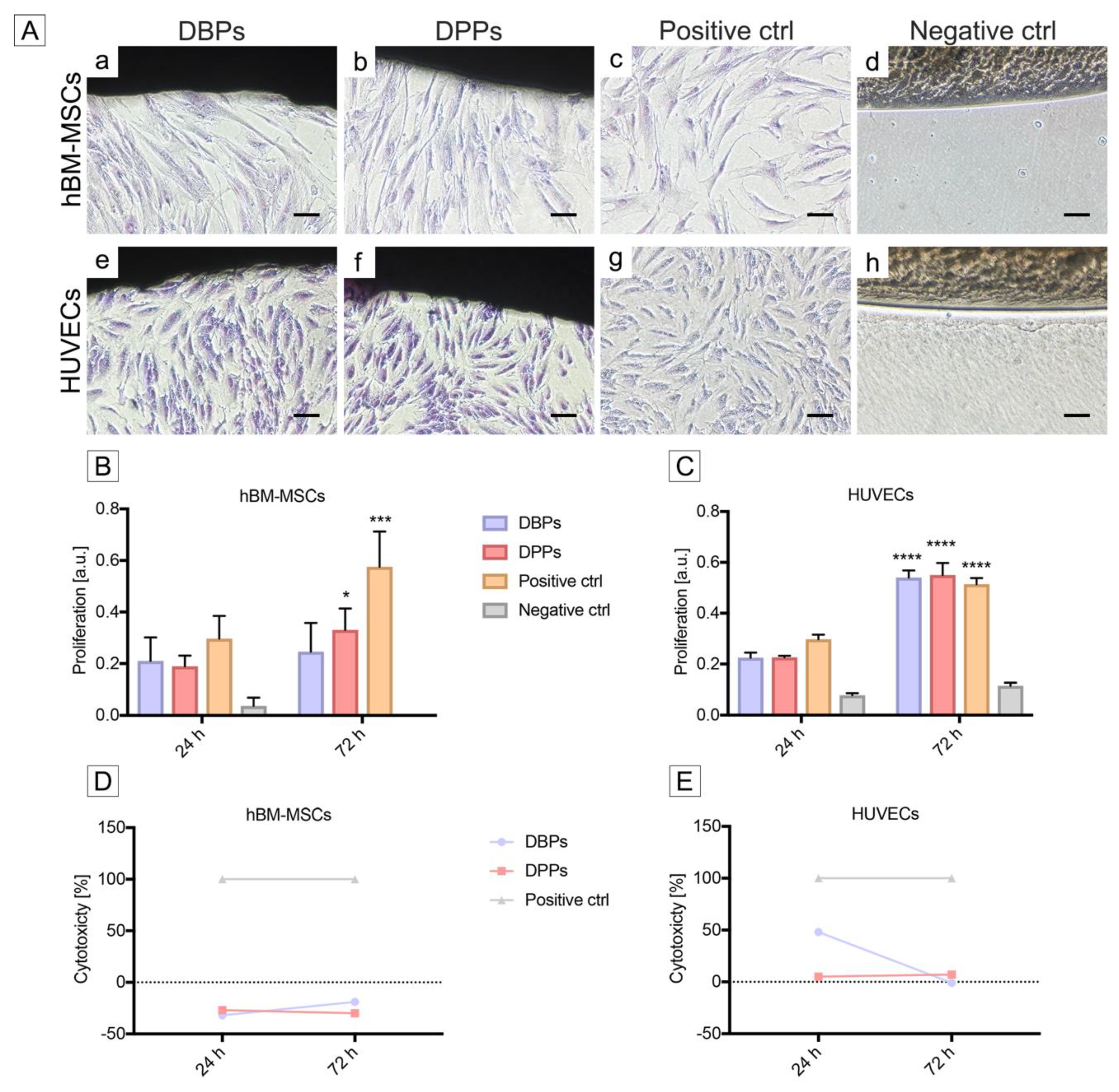 A Comprehensive Comparison of Bovine and Porcine Decellularized ...