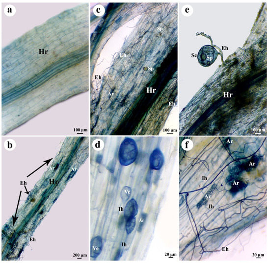 Biomolecules | Free Full-Text | Rhizophagus irregularis and Rhizoctonia ...