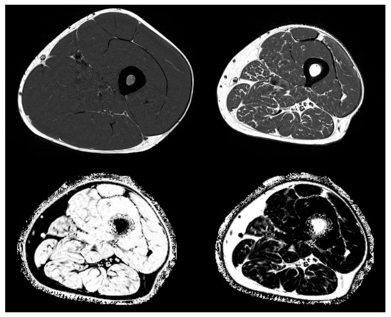 Interactions between Muscle and Bone—Where Physics Meets Biology