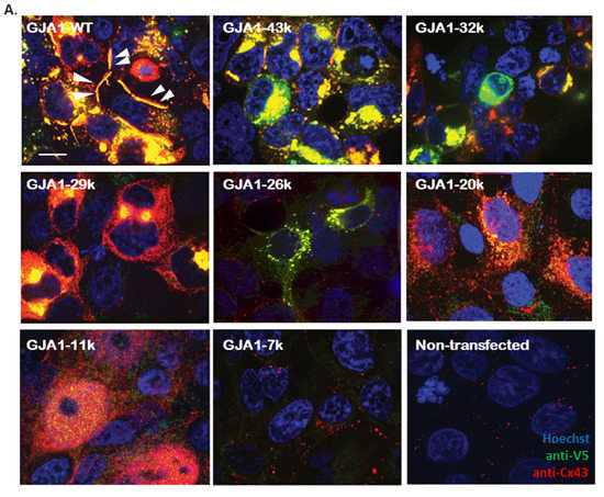 An Alternatively Translated Connexin 43 Isoform, GJA1-11k, Localizes to ...