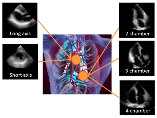 Clinically Feasible and Accurate View Classification of Echocardiographic Images Using Deep Learning