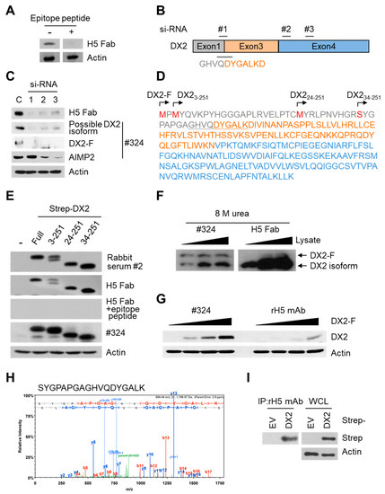 An Isoform of the Oncogenic Splice Variant AIMP2-DX2 Detected by a ...