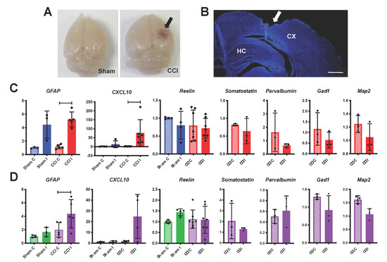 Reduced Reelin Expression in the Hippocampus after Traumatic Brain Injury