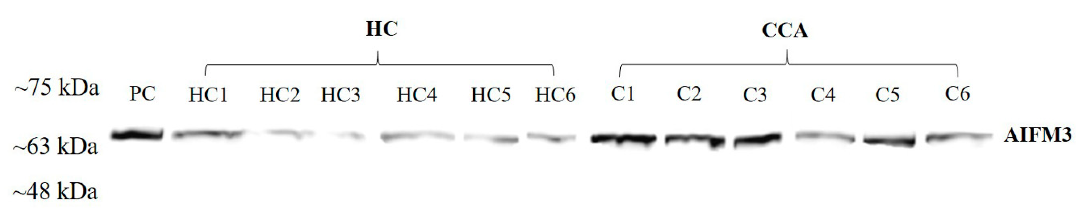 Biomolecules | Free Full-Text | Apoptosis-Inducing Factor ...