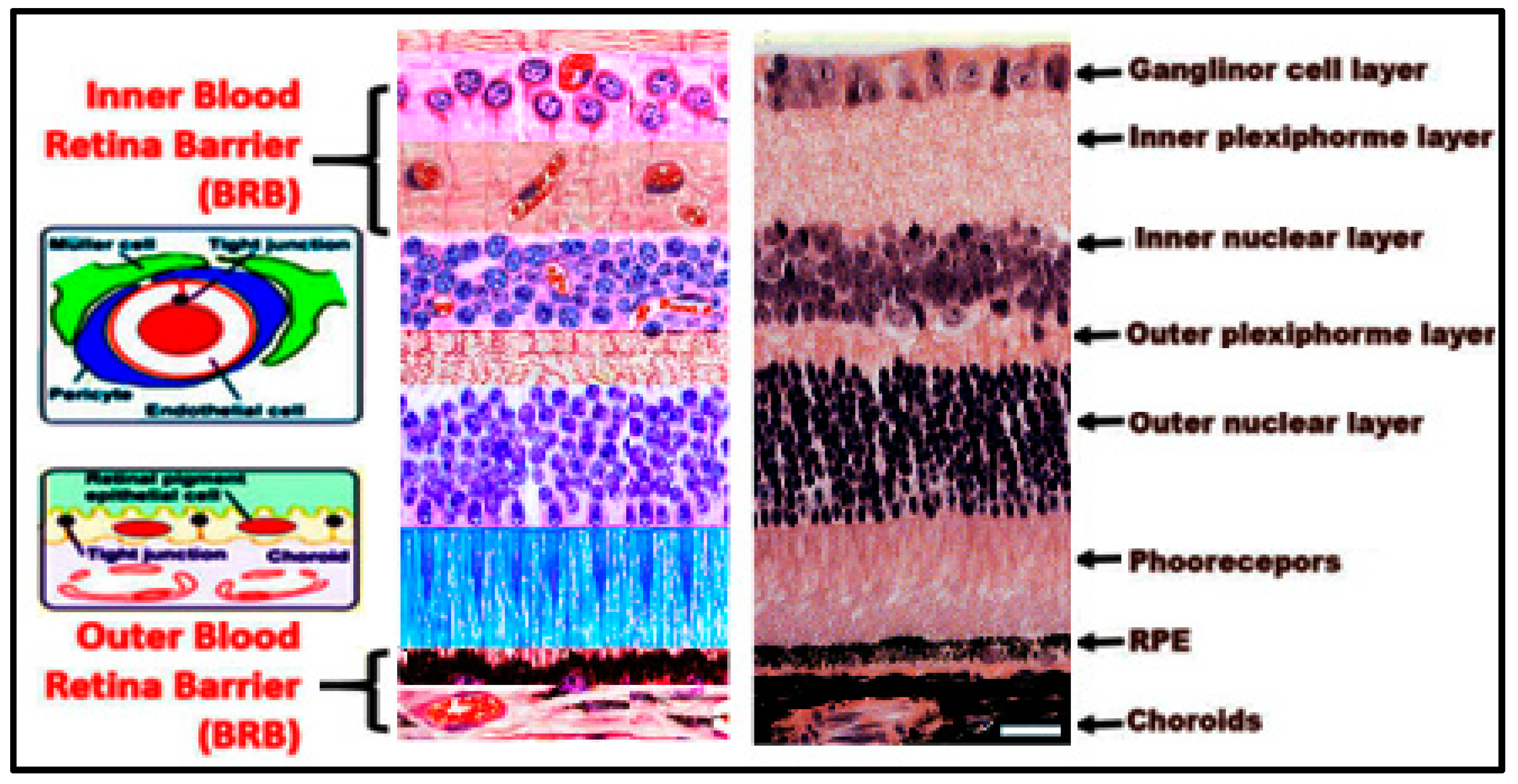 Implication of Hyperhomocysteinemia in Blood Retinal Barrier (BRB) Dysfunction