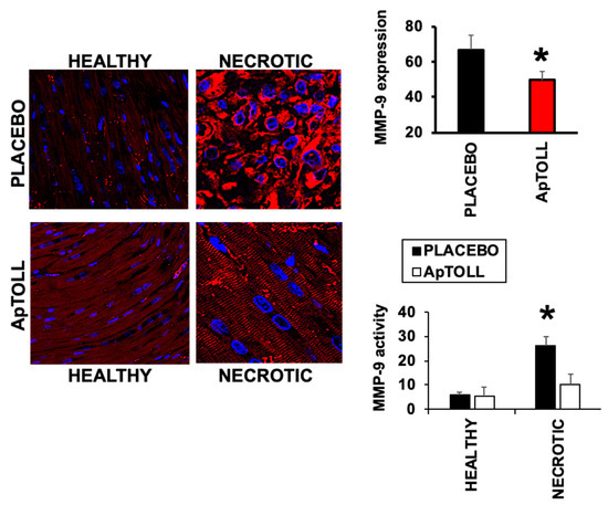 Targeting TLR4 with ApTOLL Improves Heart Function in Response to ...