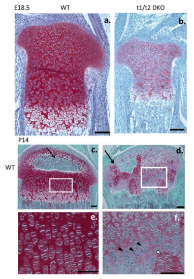 Aggrecan, the Primary Weight-Bearing Cartilage Proteoglycan, Has ...