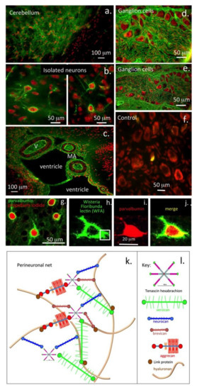 Aggrecan, the Primary Weight-Bearing Cartilage Proteoglycan, Has ...