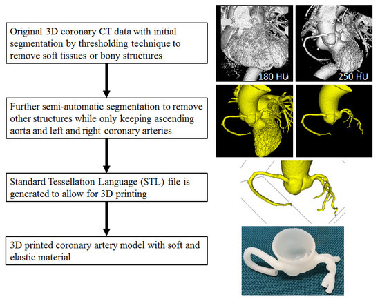 Clinical Applications of Patient-Specific 3D Printed Models in ...