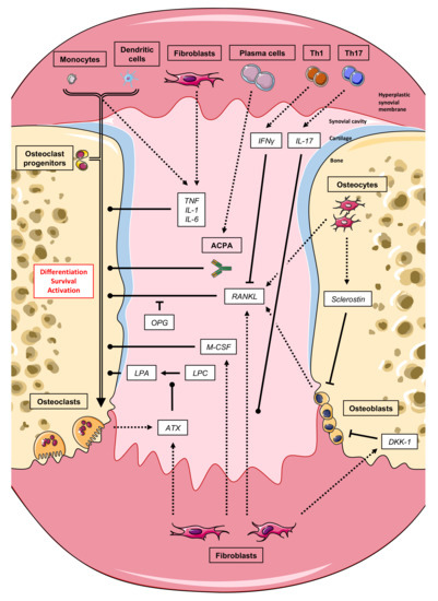 Rheumatoid Arthritis in the View of Osteoimmunology