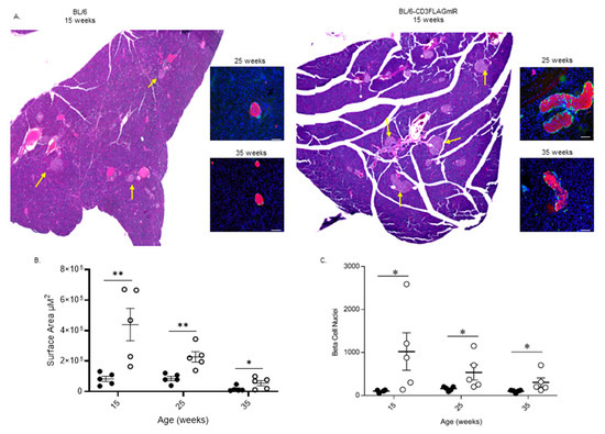 Islet Dysfunction in a Novel Transgenic Model of T Cell Insulitis