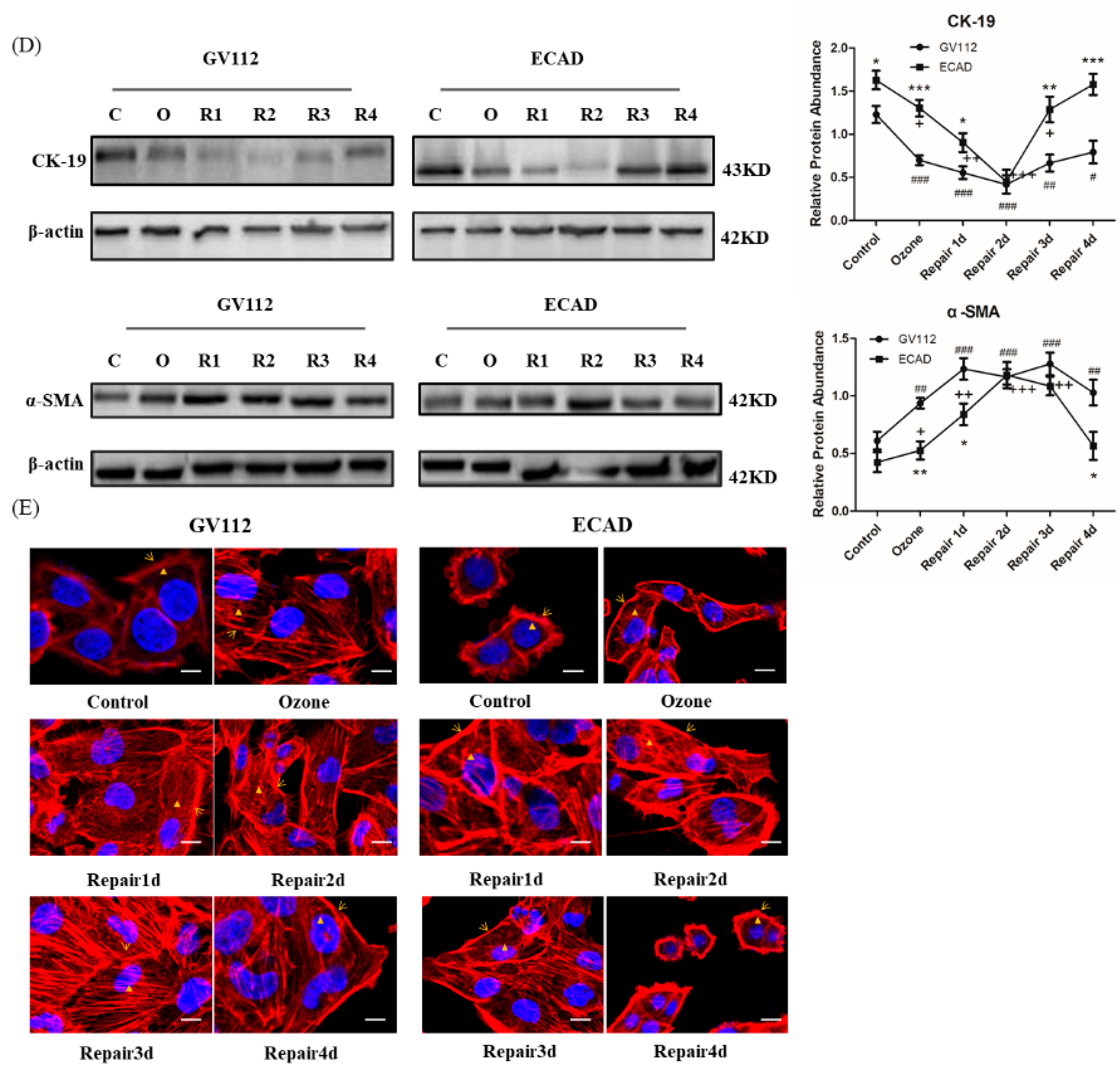 Modulation of the EMT/MET Process by E-Cadherin in Airway Epithelia ...