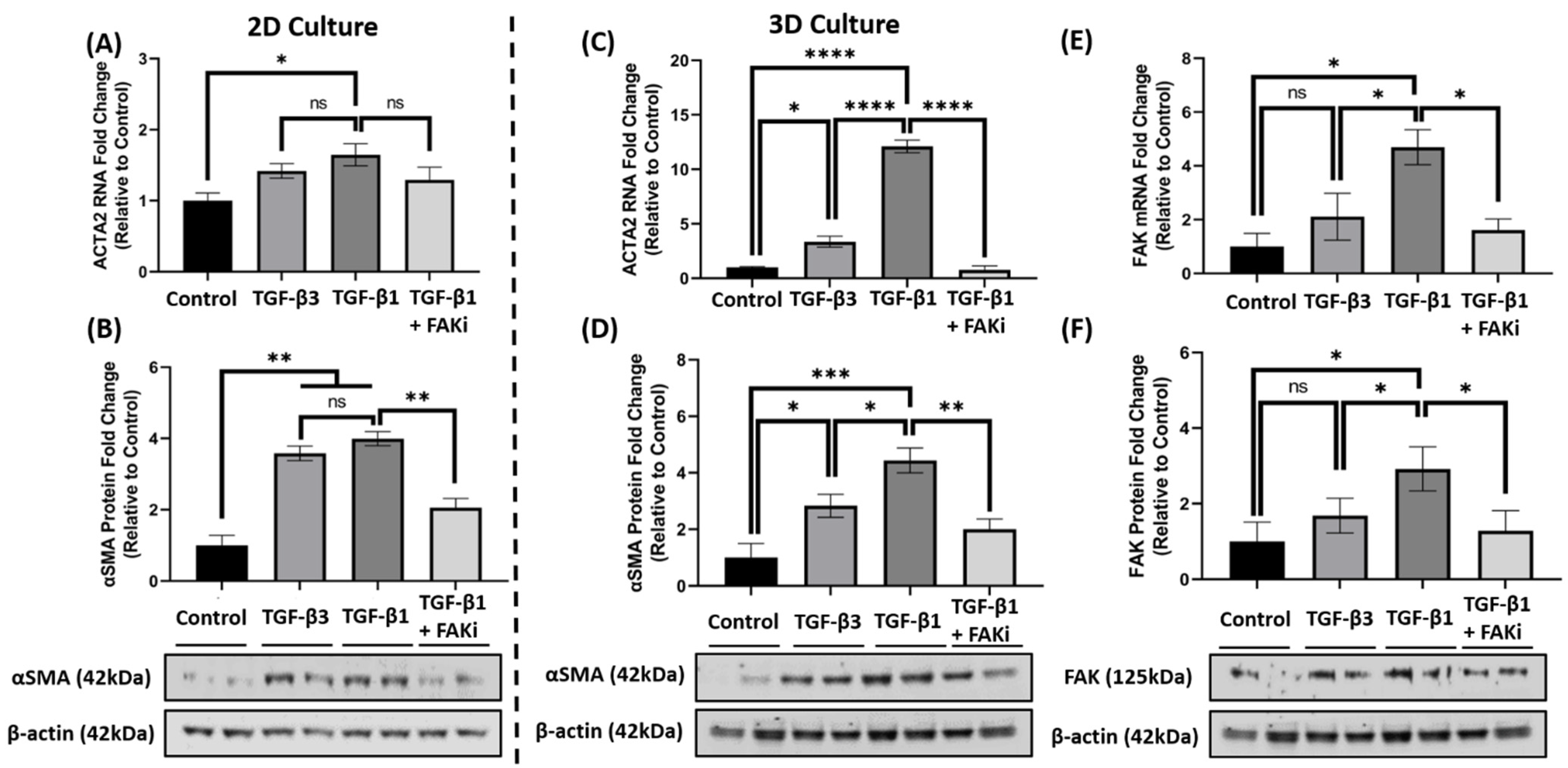 FAK Inhibition Attenuates Corneal Fibroblast Differentiation In Vitro
