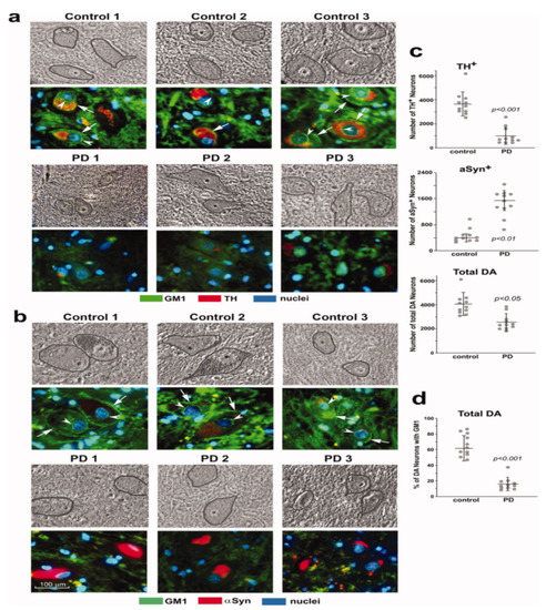 The Key Role of GM1 Ganglioside in Parkinson’s Disease
