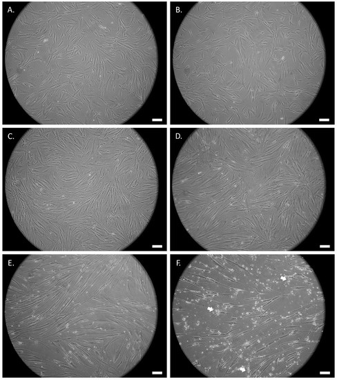 Biomolecules | Free Full-Text | Neural Differentiation of Human Dental Mesenchymal Stem Cells ...
