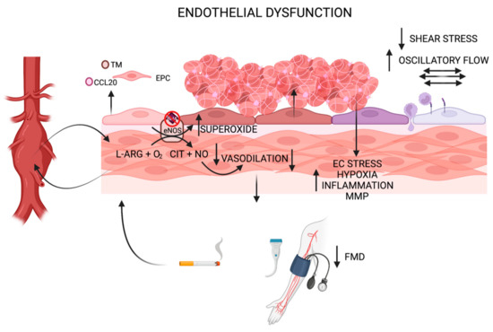 Endothelial Dysfunction in the Pathogenesis of Abdominal Aortic Aneurysm