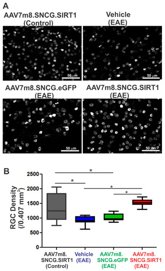 Selective Upregulation of SIRT1 Expression in Retinal Ganglion Cells by ...