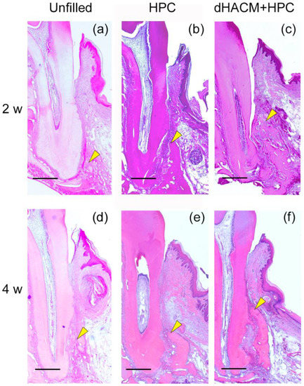 Investigating the Effects of Dehydrated Human Amnion-Chorion Membrane ...