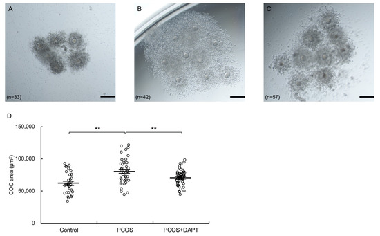 Notch Signaling Induced by Endoplasmic Reticulum Stress Notch Signaling Induced by Endoplasmic Reticulum Stress