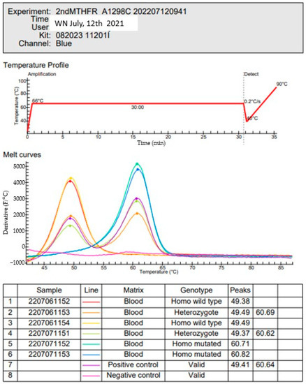 MTHFR SNPs (Methyl Tetrahydrofolate Reductase, Single Nucleotide ...