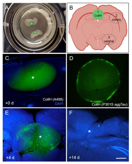 Spreading of P301S Aggregated Tau Investigated in Organotypic Mouse ...
