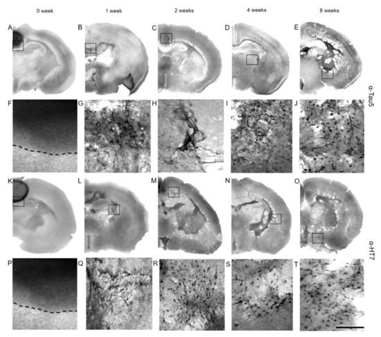 Spreading of P301S Aggregated Tau Investigated in Organotypic Mouse ...